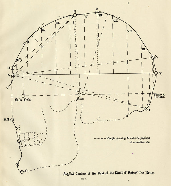 Measurements of Robert the Bruce's skull posters & prints by unknown